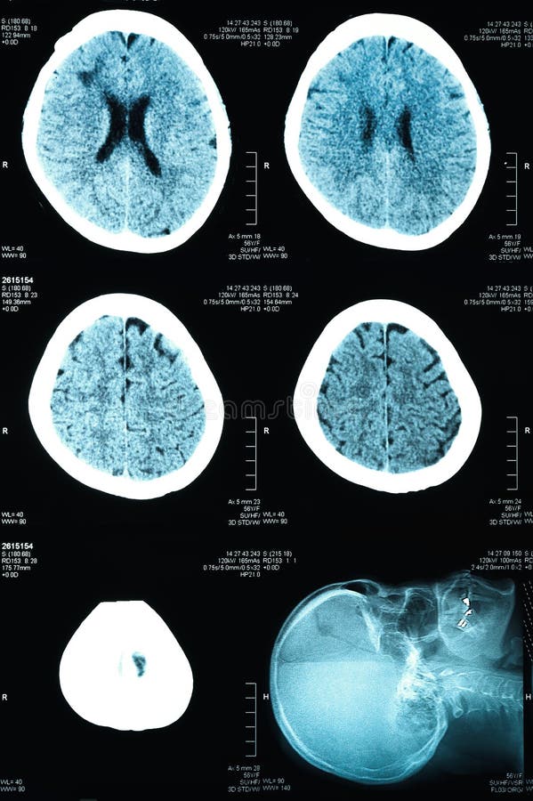 Images from a Computerized Tomography Stock Image - Image of organ ...