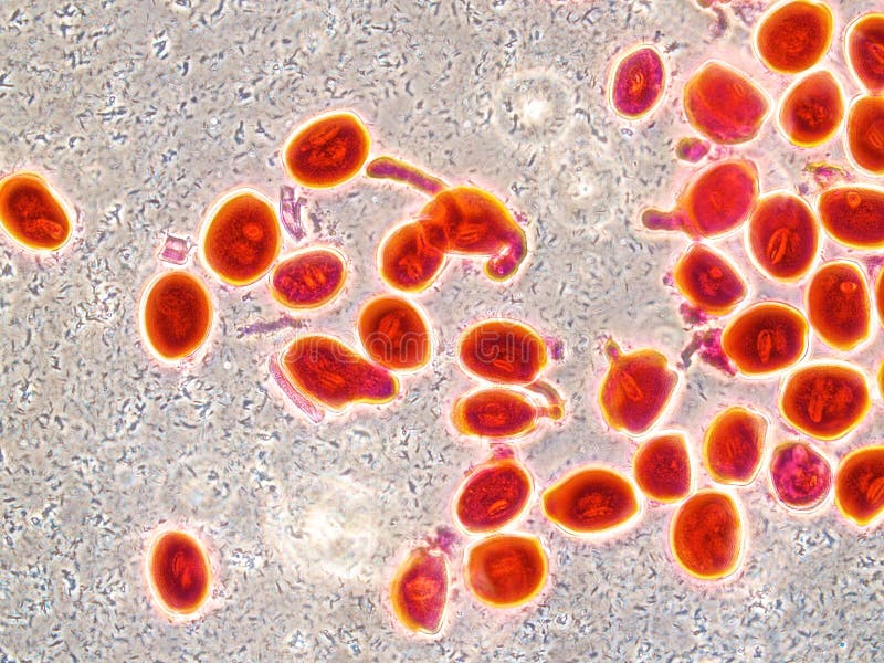 Images De Microscopie Des Globules Rouges Photo stock - Image du ...