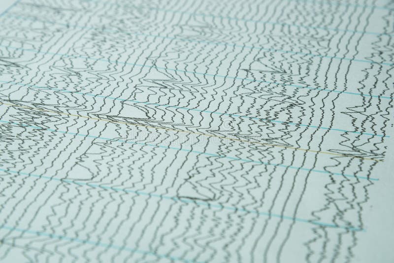 Imaging of Electroencephalography Recording of Human Stock Photo ...