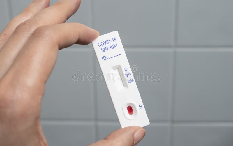 Immunity test for Covid-19 stock image. Image of medical - 193987195