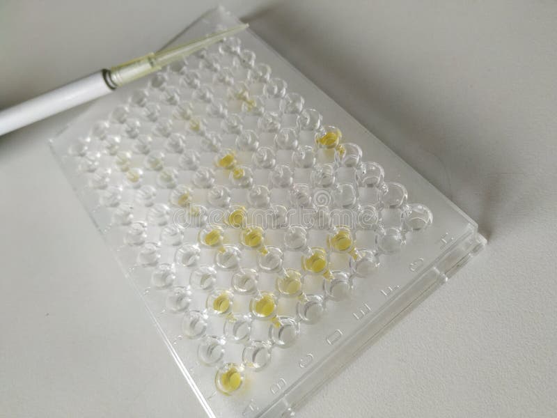 Immunology Testing Method in Laboratory Stock Photo - Image of ...