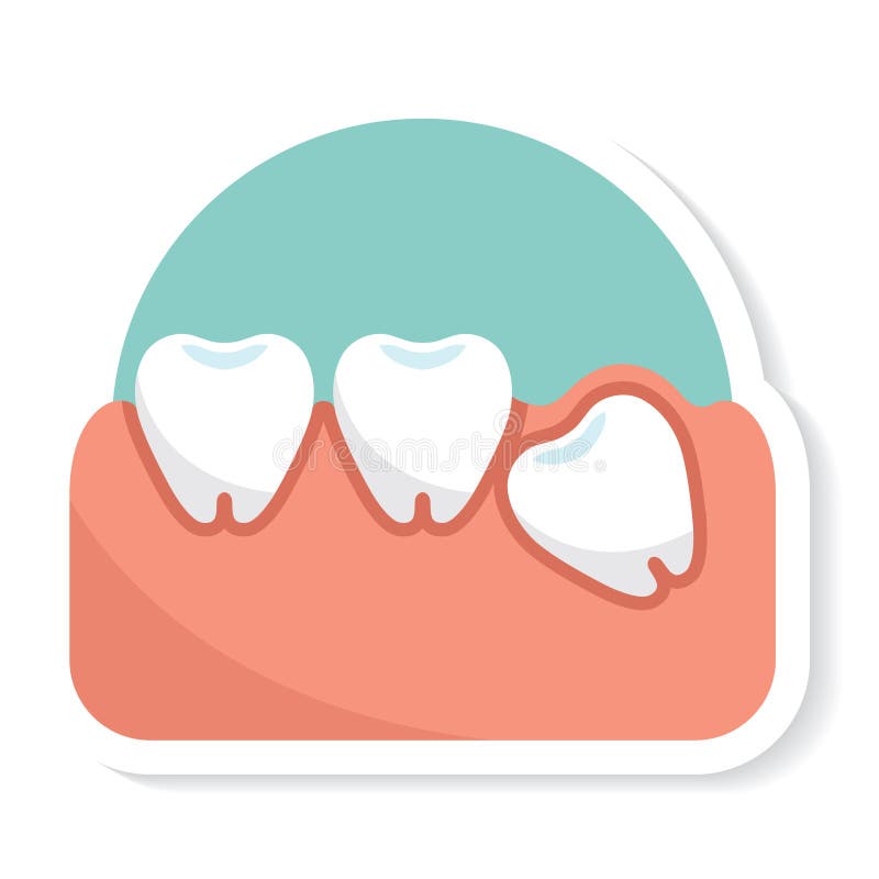 Impacted Tooth. Vector Illustration Decorative Design Stock Vector ...