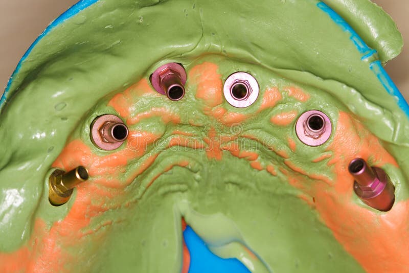 Dental impression stock image. Image of prosthetics, imprint - 13823963