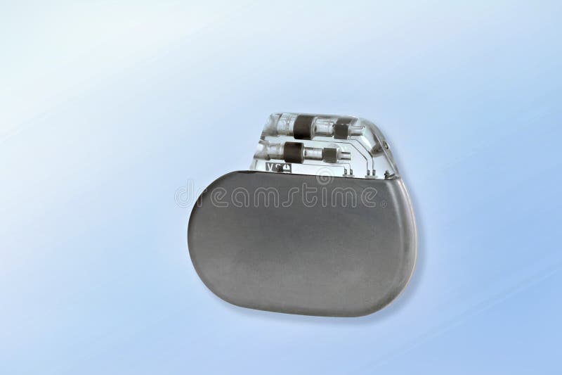 Cardiac Pacemaker on Blue Background Stock Image - Image of cardio ...