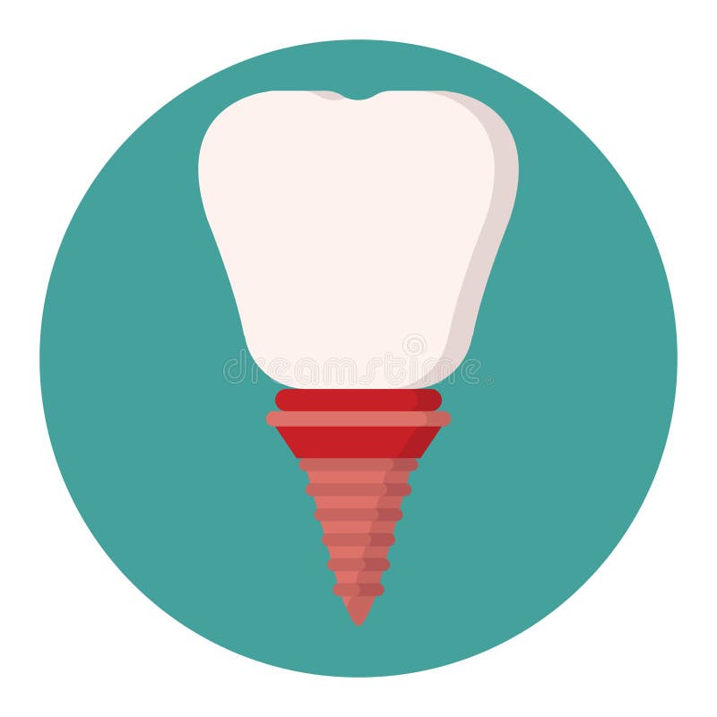 Implant. Vector Illustration Decorative Design Stock Vector ...