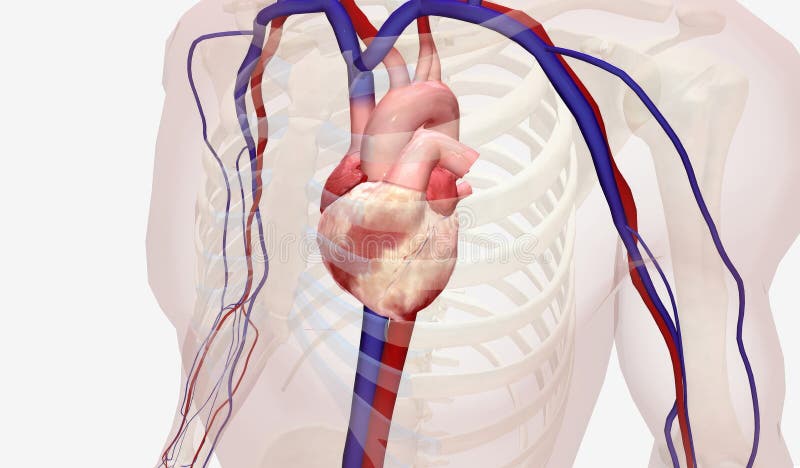 The Implantable Loop Recorder Placement Stock Illustration ... The Implantable Loop Recorder Placement Stock Illustration ...