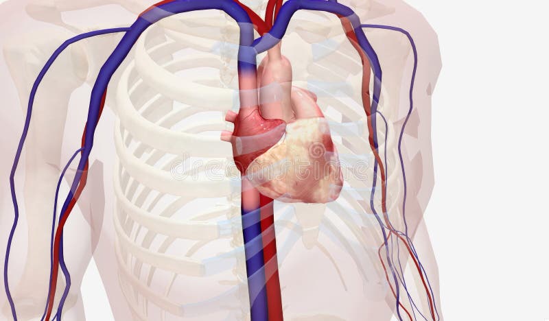 The Implantable Loop Recorder Placement Stock Illustration ...