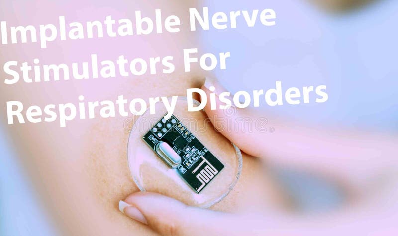 Implantable Nerve Stimulators for Respiratory Disorders Implantable ...