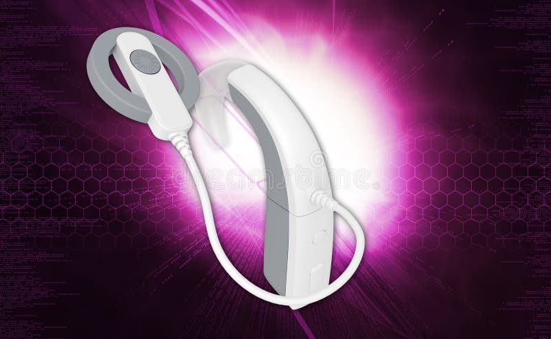 Implante coclear ilustración del vector. Ilustración de ciencia - 116733685