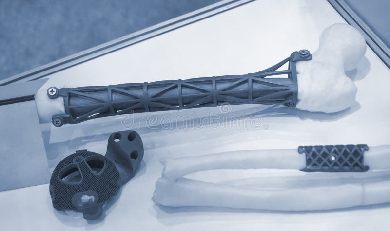 Implants and Prostheses Printed on 3D Printer from Biocompatible ...