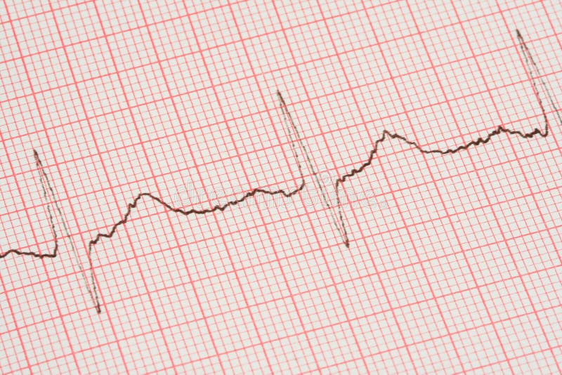 Impression de cardiographe photo stock. Image du toujours - 5374446