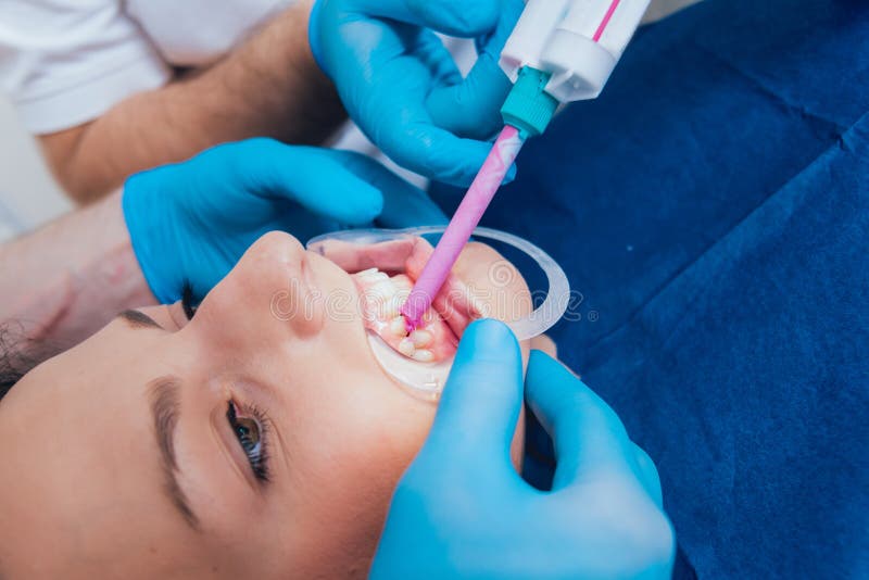 Impression Taking and Bite Registration. Functional Diagnostics Stock ...