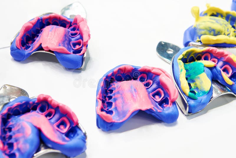 Impression of teeth stock photo. Image of gypsum, material - 218922908