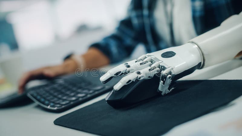Inclusive Office: Person with Disability Using Prosthetic Arm To Work ...