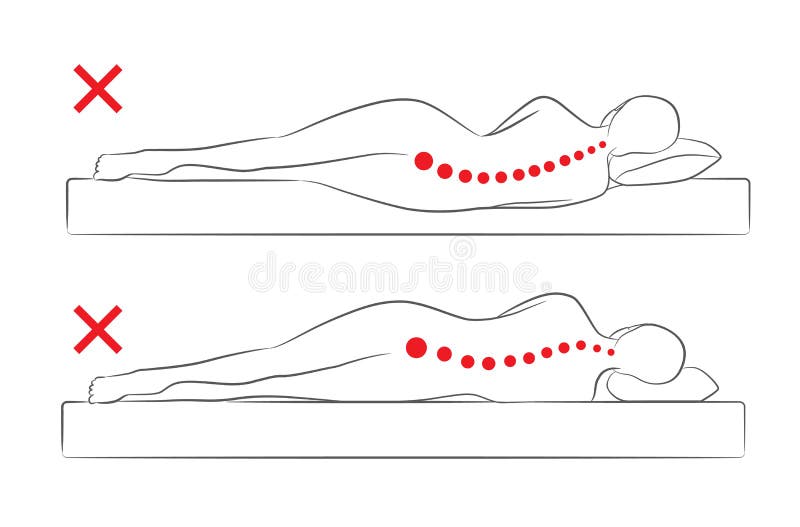 The Incorrect Spine Alignment when Sleeping. Stock Vector ...