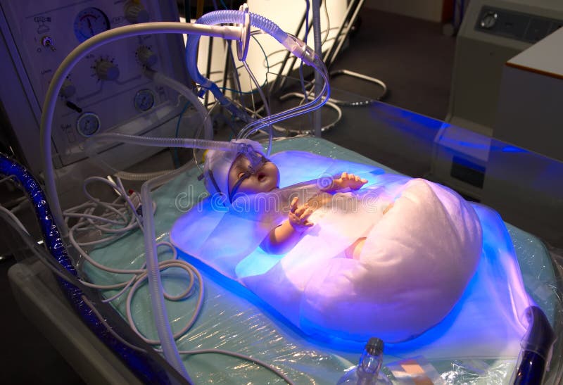 Newborn in Isolette 3 stock image. Image of tiny, bilirubin - 1587319