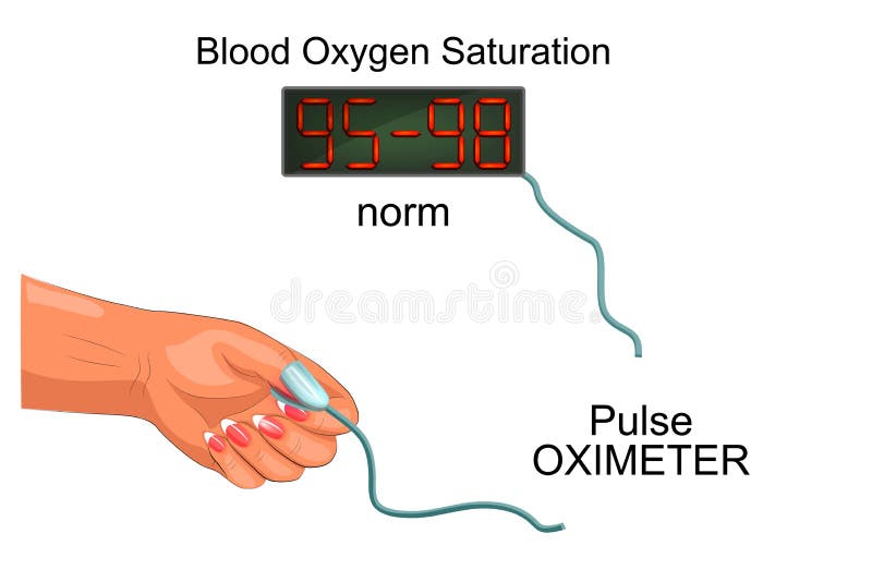 Oxygen Saturation Stock Illustrations – 95 Oxygen Saturation Stock ...