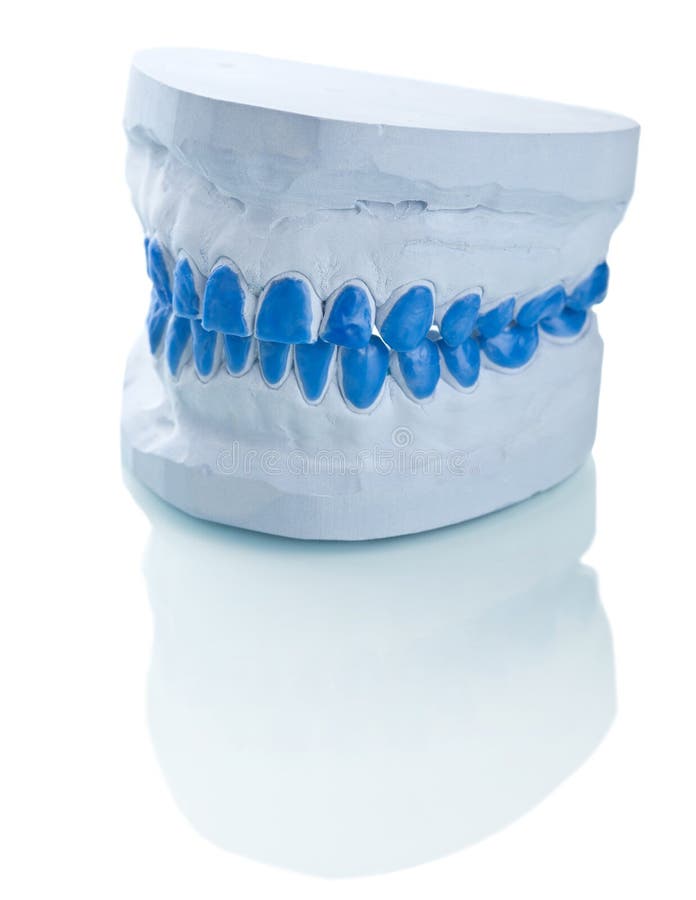Individual Plaster Dental Molds To Make Trays Stock Photo - Image of ...