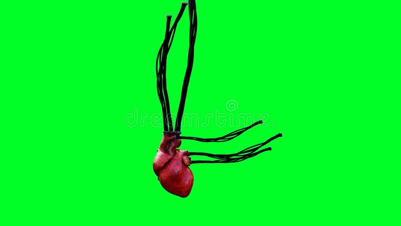 Infarct, Heart Contraction, Green Screen. 3d Rendering. Stock ...