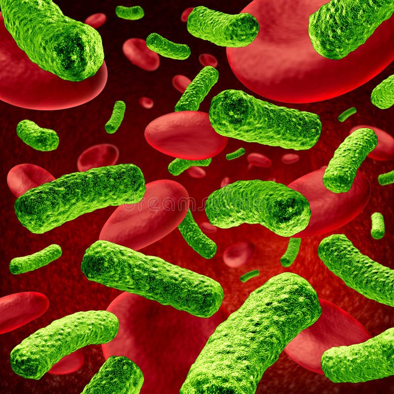 Sepsis Empoisonnement Du Sang E Coli Streptocoques Pneumococci ...