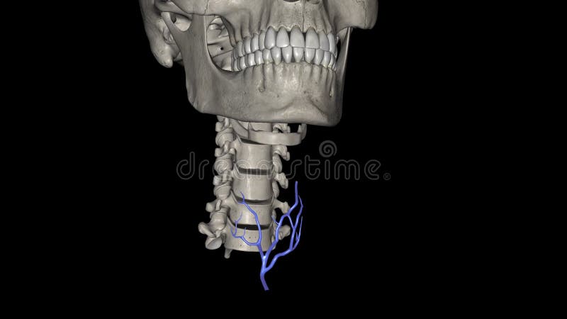 The Inferior Thyroid Veins and Their Multiple Tributaries are the ...