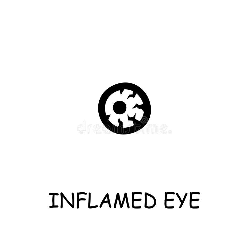Eye Irritation. Inflamed Bloodshot Eyeball with Red Conjunctiva ...