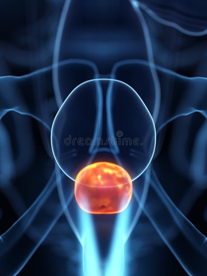 An inflamed prostate stock illustration. Illustration of internal ...