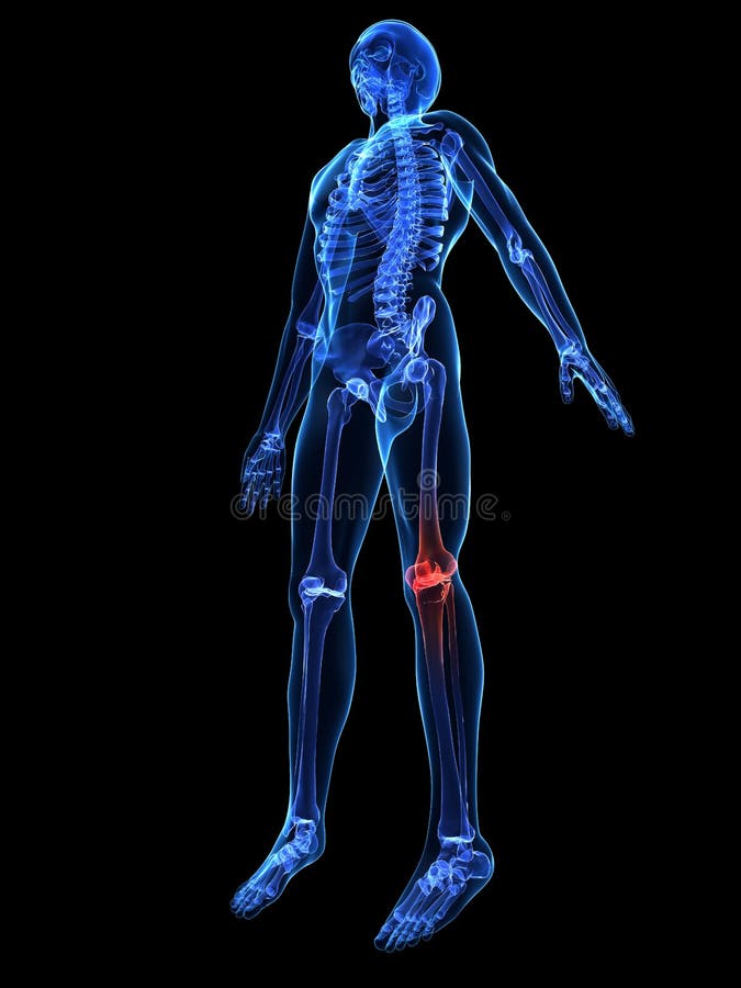 Inflammated knee stock illustration. Illustration of skeletal - 6787758