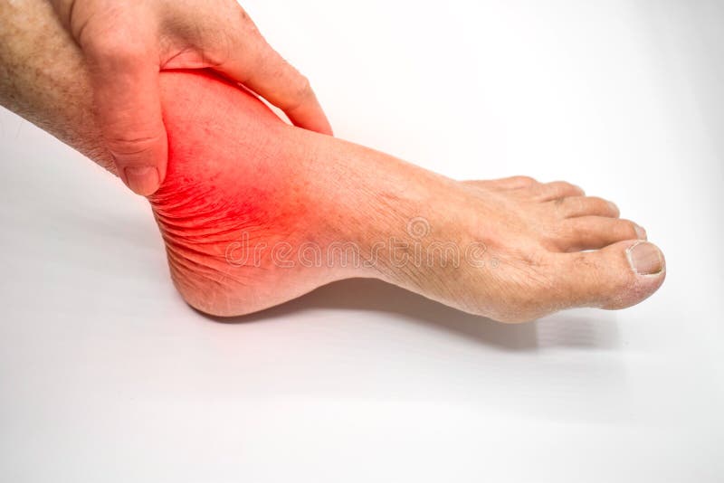 Ankle Redness Pain Stock Photos - Free & Royalty-Free Stock Photos from ...