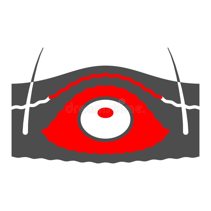 Connective Tissue Icon Stock Illustrations – 415 Connective Tissue Icon ...