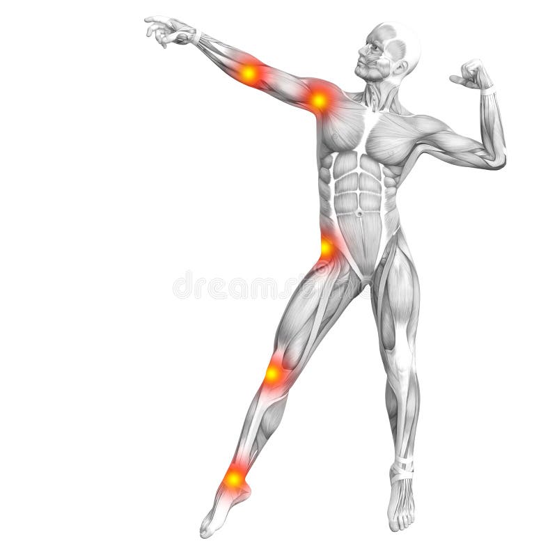 Inflammation De Tache Rouge Et Jaune D'anatomie De Muscle Illustration ...