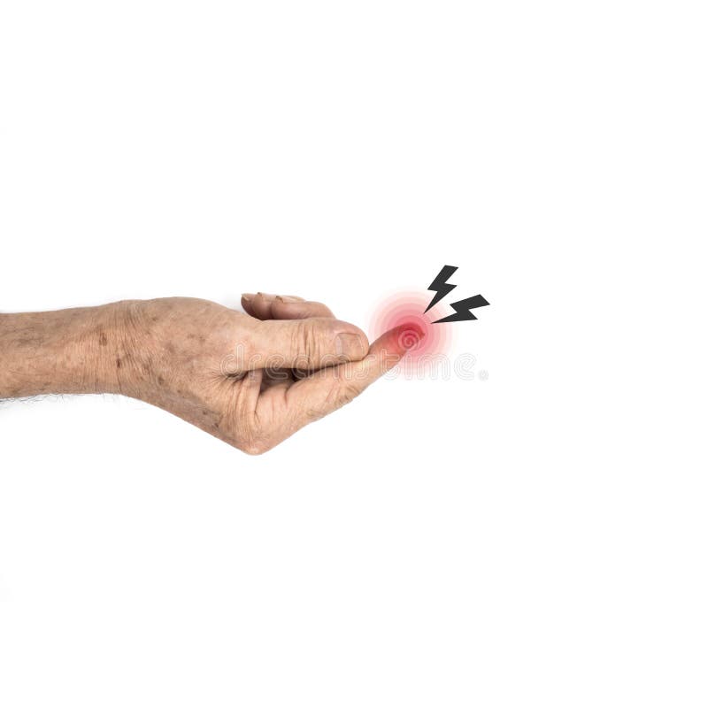 Inflammation in Fingertip of Asian Man. Concept of Cellulitis and ...