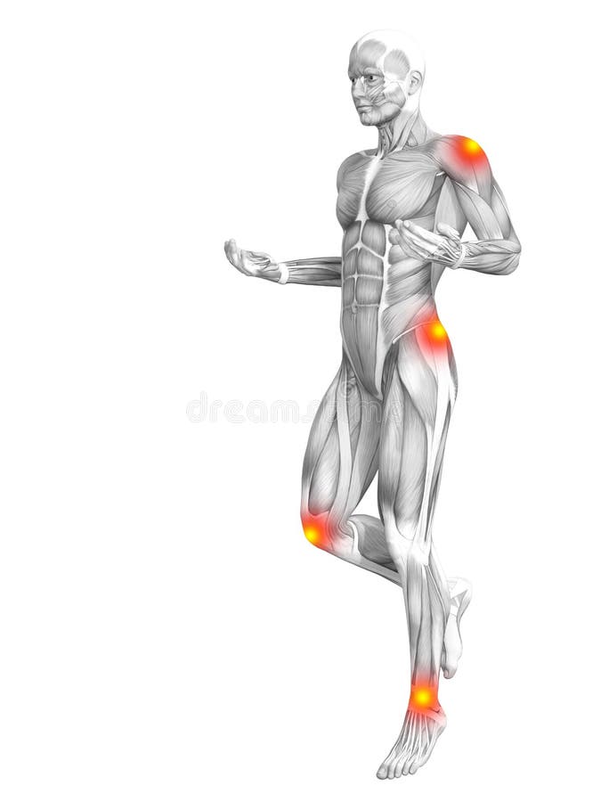Inflammation De Tache Rouge Et Jaune D'anatomie De Muscle Illustration ...
