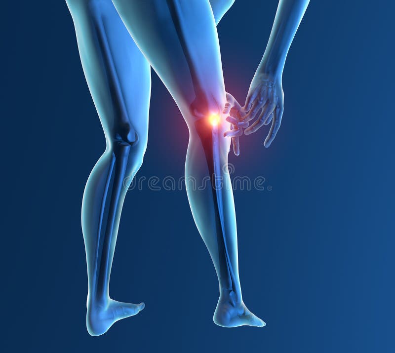 Inflammation Pain Knee Skeleton X-ray Stock Illustration - Illustration ...