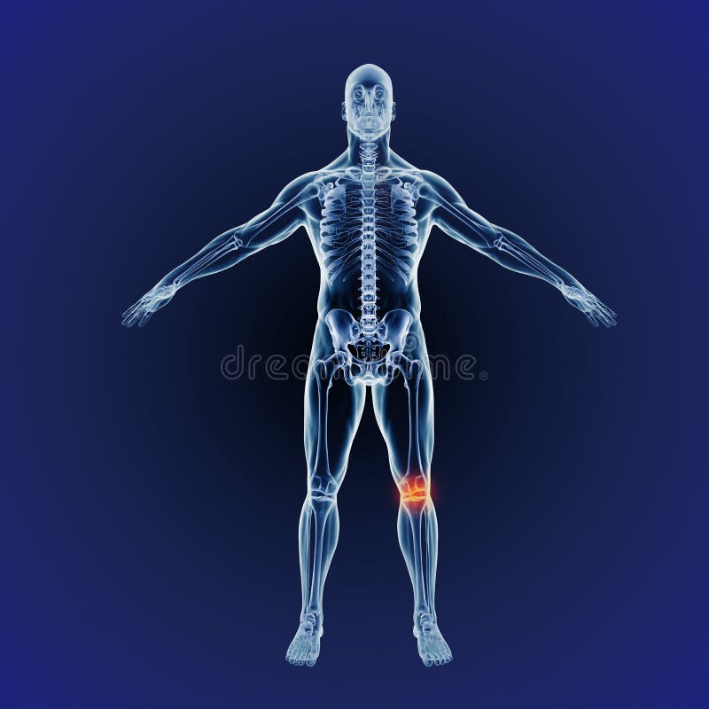 When Inflammation Strikes. a Full Length Cgi Representation of the ...