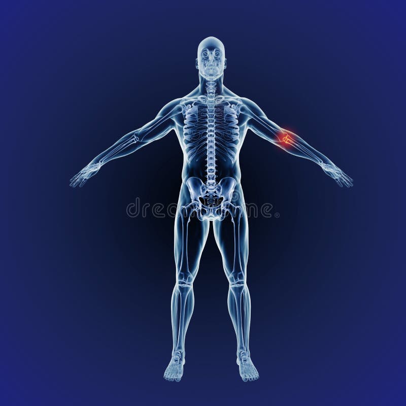 When Inflammation Strikes. a Full Length Cgi Representation of the ...