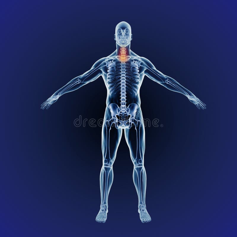 When Inflammation Strikes. a Full Length Cgi Representation of the ...