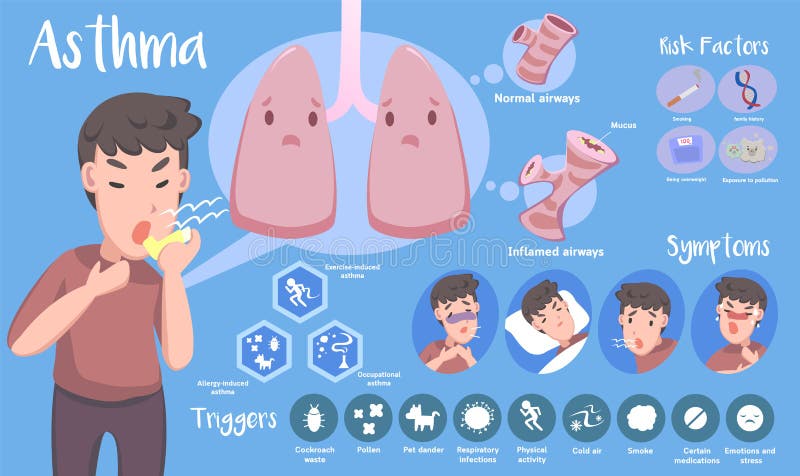 Infographic of Asthma stock vector. Illustration of airway - 163252636