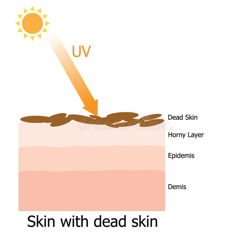 Infographic about Dead Skin Stock Illustration - Illustration of rays ...