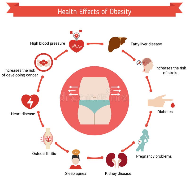 Infographic Gezondheid En Gezondheidszorg Vector Illustratie ...