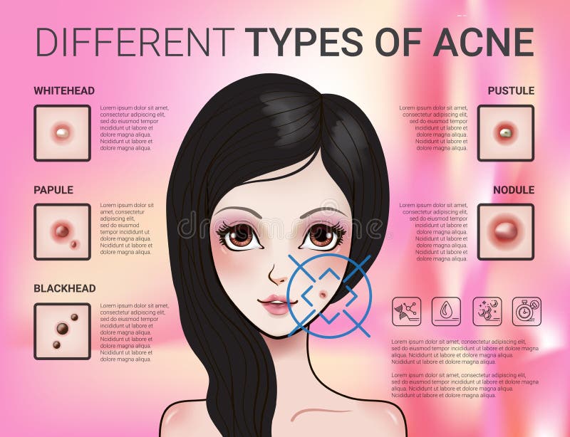 Infographics of the Skin Problem. Transformation Stock Vector ...