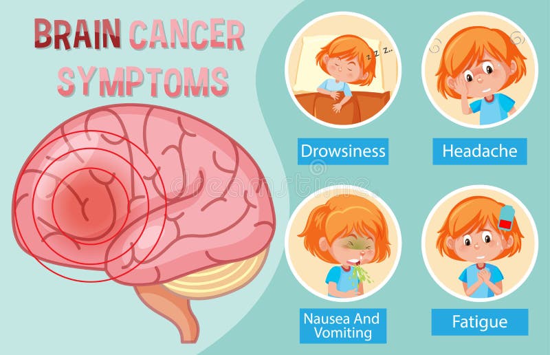 Information Poster of Human Brain Diagram Stock Vector - Illustration ...