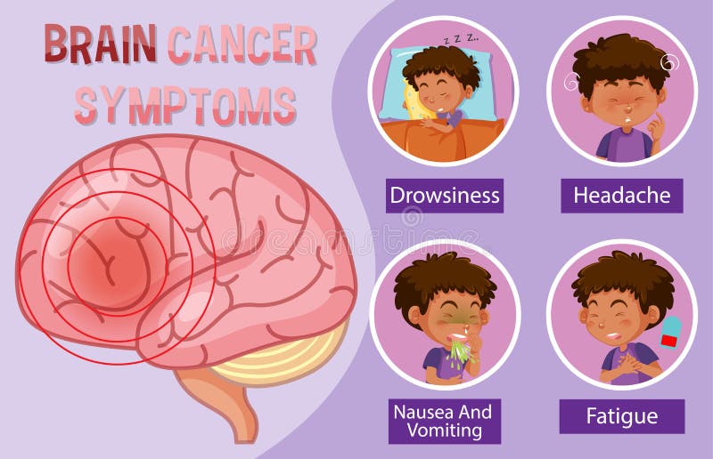 Information Poster of Human Brain Diagram Stock Vector - Illustration ...