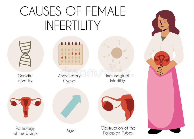 Information Vector Poster About The Causes Of Female Infertility Stock