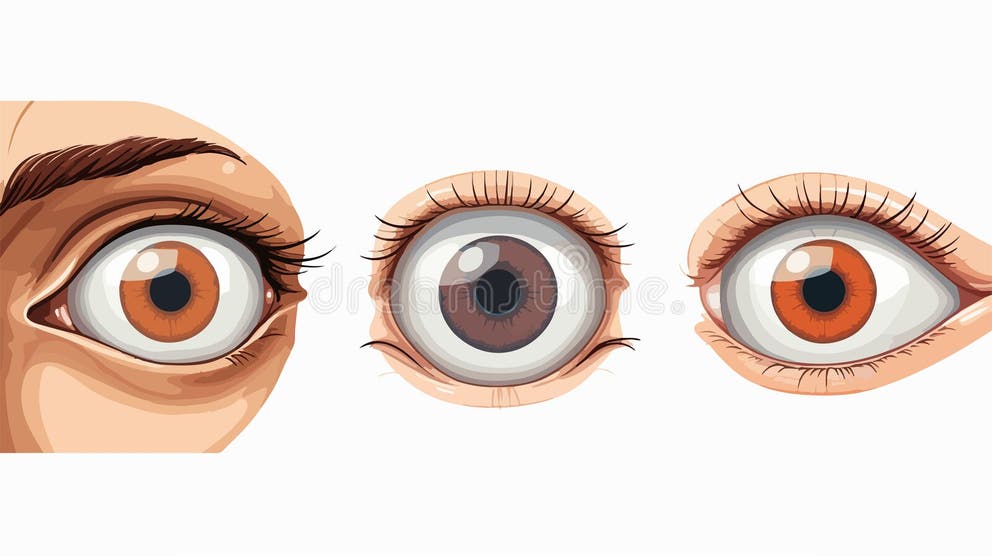 Informative Chart Detailing Myopia Hyperopia and Vision Health Stock ...
