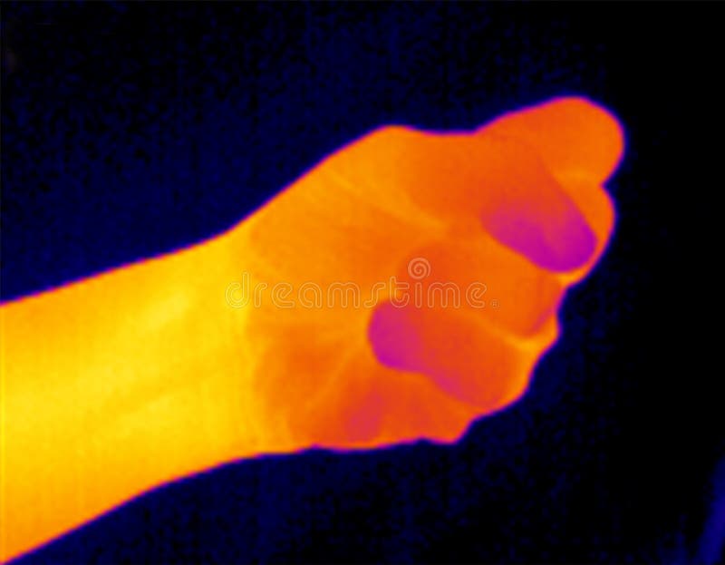 Infrared Photo of Human Hand Stock Image - Image of person, colored ...