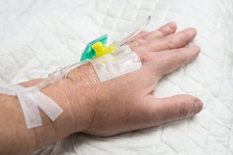 Infusion given into hand stock photo. Image of peripheral - 50844556