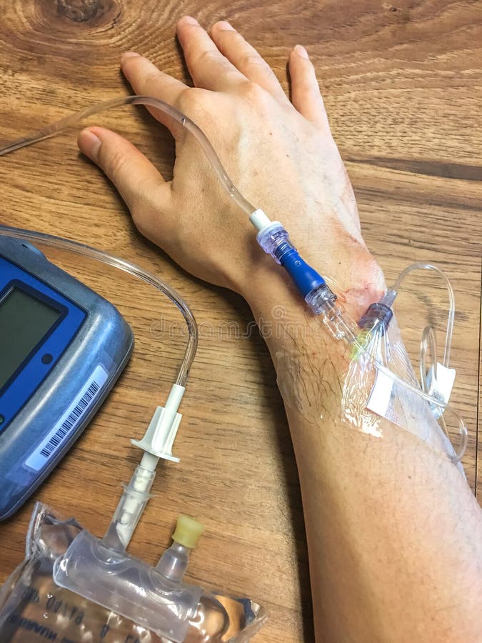 Infusion or IV injection. stock photo. Image of care - 100929598