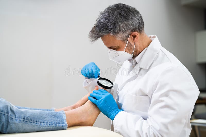 Ingrown Toenail Problem stock photo. Image of ingrown - 213595040