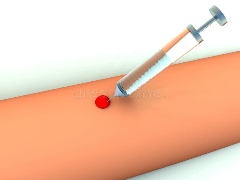 Injection Picture. Image: 1589529